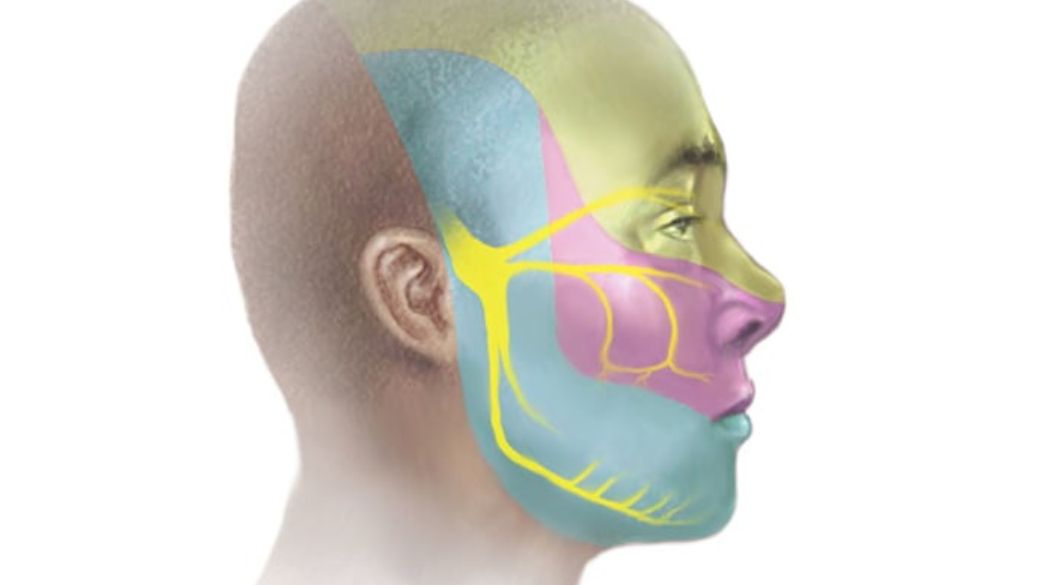 Conoce la nueva técnica quirúrgica para tratar la neuralgia del ...